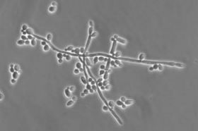 Reino Fungi - Toda Matéria