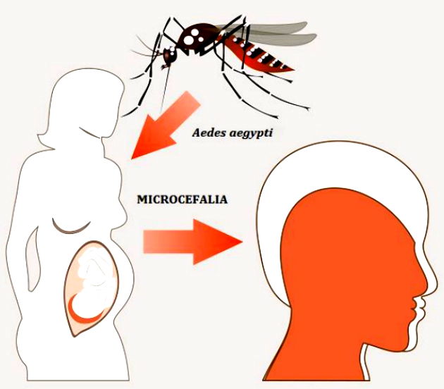 Zika: transmissão, sintomas e tratamento - Toda Matéria